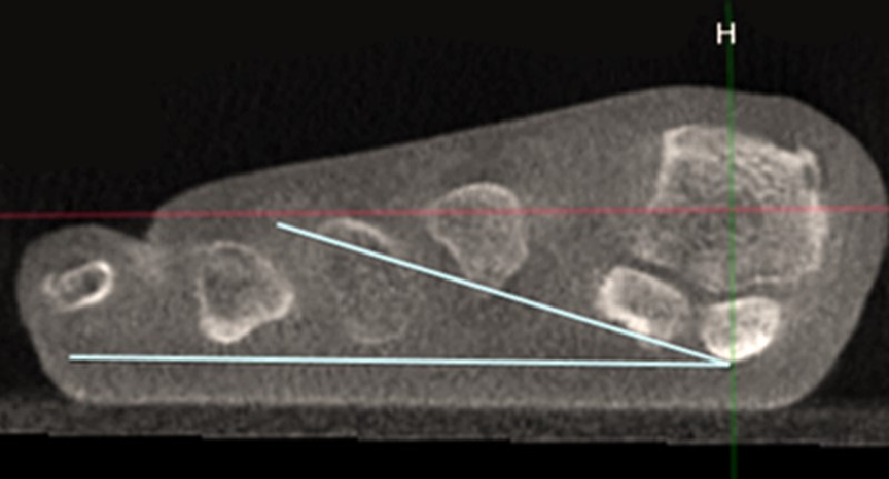 KSUCPM Faculty and Students Conduct Research Using CurveBeam pedCAT ...