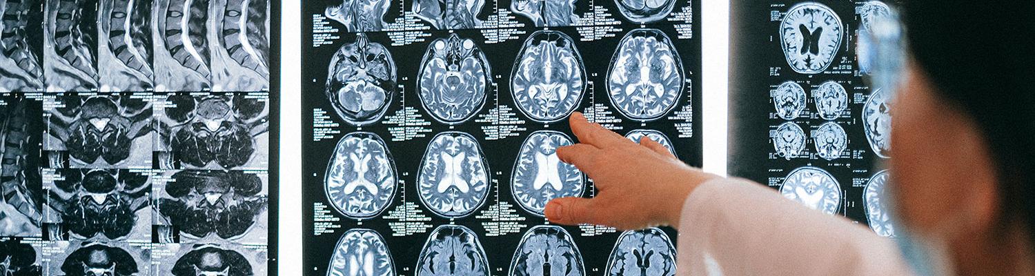 Radiology Certificates | Kent State University